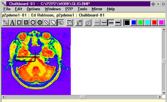 File:P2p1.gif - OS2World.Com Wiki